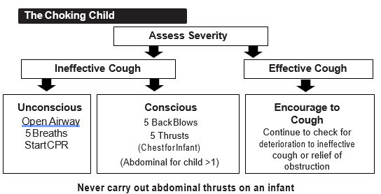 How to save a choking child - Aid Training
